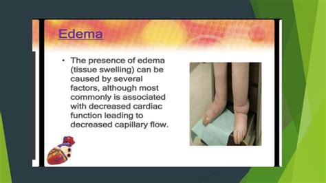 Cardiovascular And Peripheral Assessmentpptx