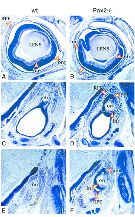 Retinal Expansion In Pax2 Deficient Mouse Embryos Cresyl Violet