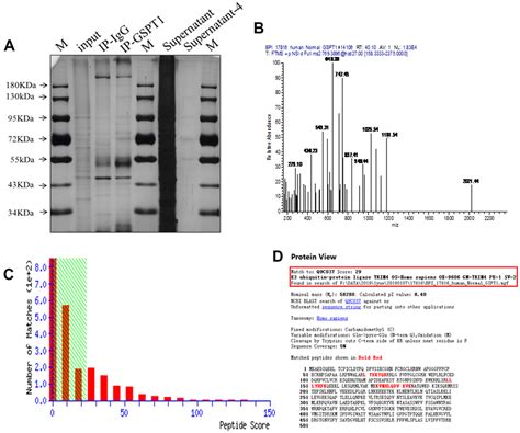 Identification Of Gspt1 As Prognostic Biomarker And Promoter Of