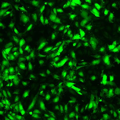 Green Fluorescent Immortalized Human Aortic Endothelial Cells Cells Online