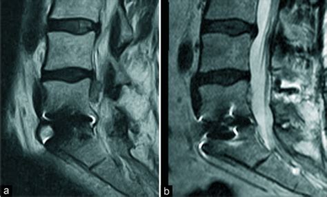 Surgical Neurology International