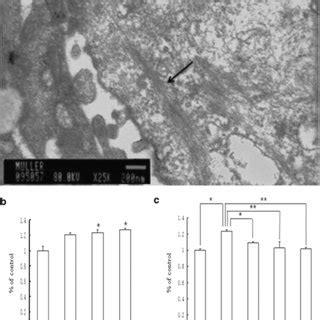 A Representative Electron Microscopic Image Of Müller Cells An