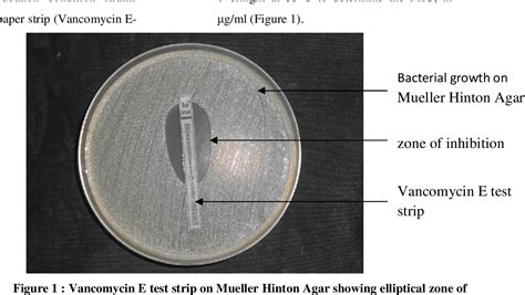 Figure 1 From Comparison Of Vancomycin Mic Against Methicillin