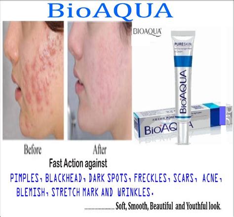 Welcome To Fantabulous Trades...: BioAQUA Pure Skin Acne Cream - 2016