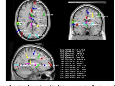 Figure 1 From Eeg Signal Analysis For Early Detection Of Critical Road Events And Emergency