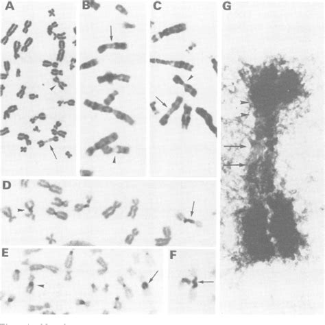Figure 1 From Constitutive Heterochromatin Region That Behaves Like The Surrounding An Extra