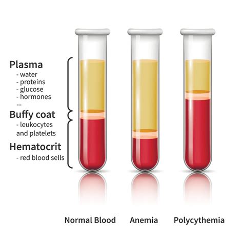 Hematocrit Test