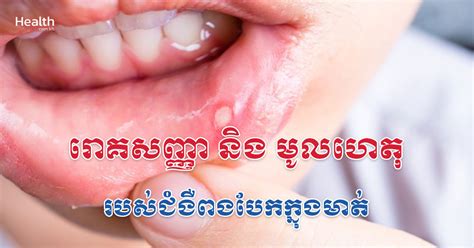 រោគសញ្ញា និង មូលហេតុ របស់ ជំងឺ ពងបែក ក្នុង មាត់