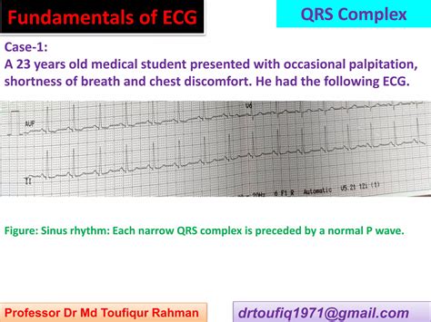 Approach To A Patient With Qrs Complex Abnormality In Ecg Ppt