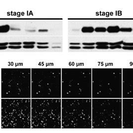 LPP Is Upregulated In Invasive EC And Promotes Invasion A LPP Download Scientific Diagram