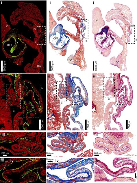 Transverse Cardiac Sections Of The Loggerhead Sea Turtle Caretta