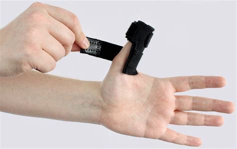 Ulnar Collateral Ligament Thumb Splint