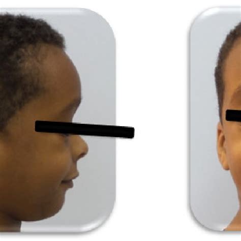 Tooth Formation Stages According To Moorrees Et Al Download Scientific Diagram