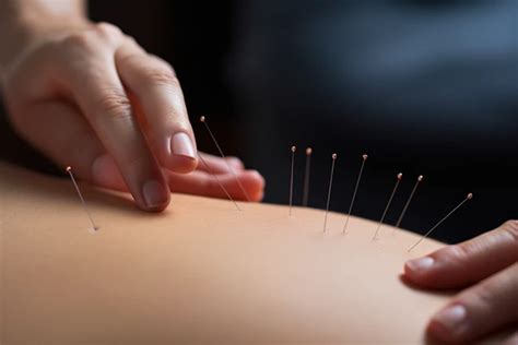 医学医疗中医养生针灸摄影图片 花瓣网