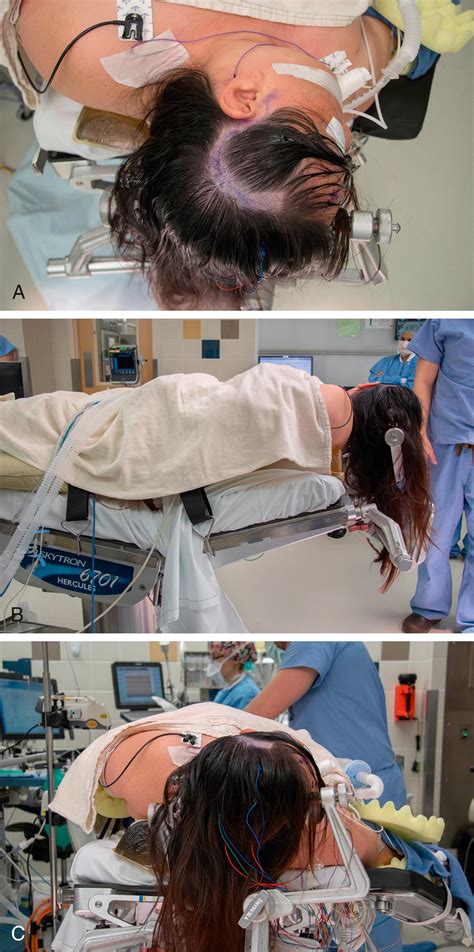 Positioning For Cranial Surgery Clinical Tree