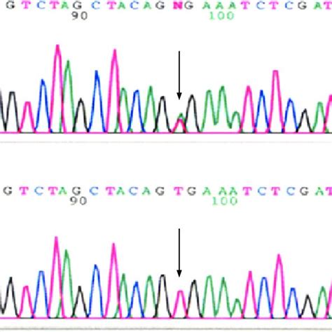 Detection Of Braf V600e Mutation In Benign Thyroid Lesions And Download Table