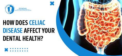How Does Celiac Disease Affect Your Dental Health