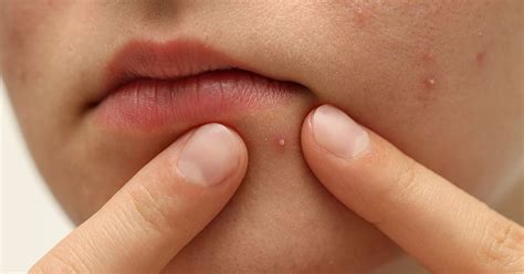 Face Irritation Bumps