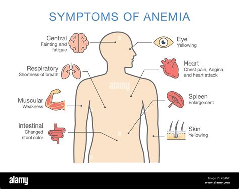 Anemia Rash Symptoms Images And Treatment Cat Miliary Dermatitis
