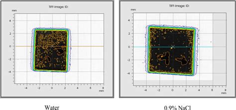 Films Irradiated When The Balloon Applicator Is Filled With Nacl And Water Download Scientific