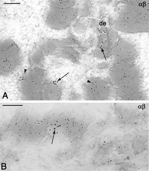 Double Immunolabeling For Alpha And Beta Keratins Using The A 30 10