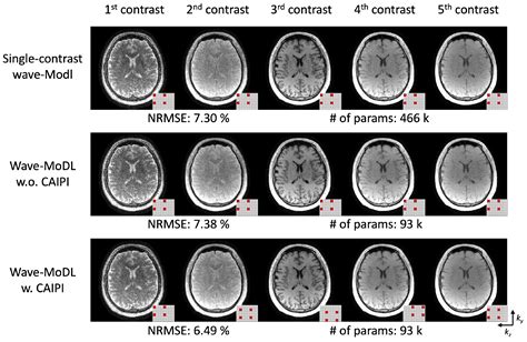 Wave Encoded Model Based Deep Learning For Highly Accelerated Imaging With Joint Reconstruction