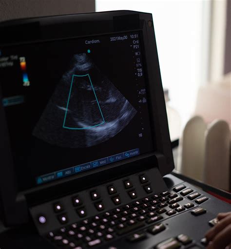 Degenerative Valve Disease Myxomatous Mitral Valve Disease Fact Sheet