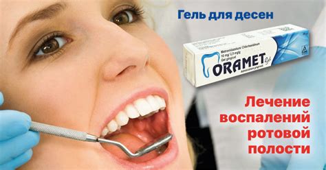 Революция в области гигиены полости рта: гель для десен Oramet с ...