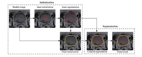 The Workflow Of The Cdls Method For Bladder Wall Segmentation Colour