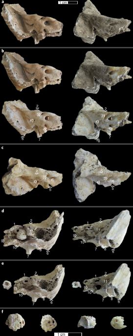 Isolating The Human Cochlea To Generate Bone Powder For Ancient Dna