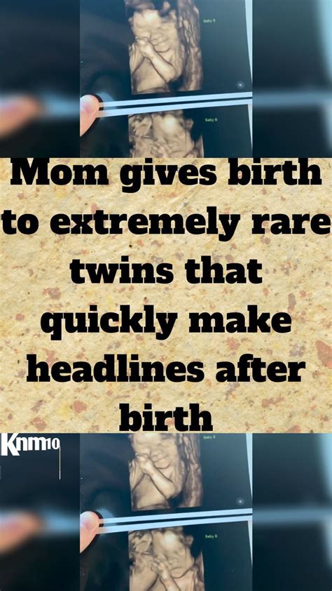 Mom Gives Birth To Extremely Rare Twins That Quickly Make Headlines