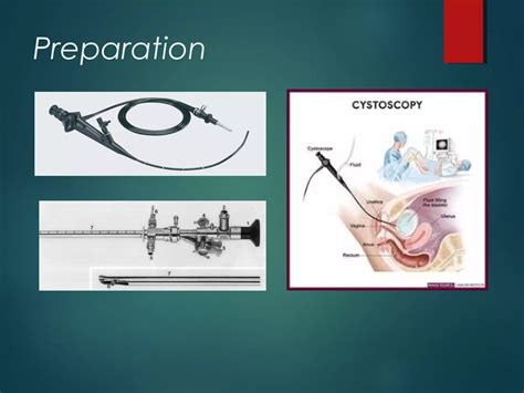Cystoscopy Ppt