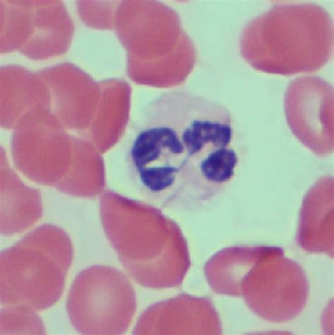 Figure 1 From Detection Classification And Counting Rbcs And Wbcs Using Deep Learning