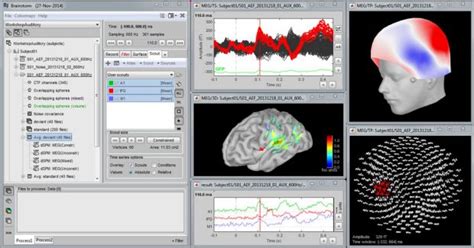 Brainstorm A Matlab Based Open Source Application For Advanced Meg
