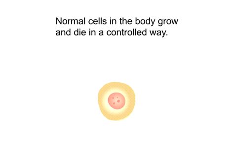 Leukemia