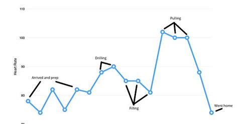 I Recently Went To The Dentist For 3 Fillings And To Have 1 Wisdom