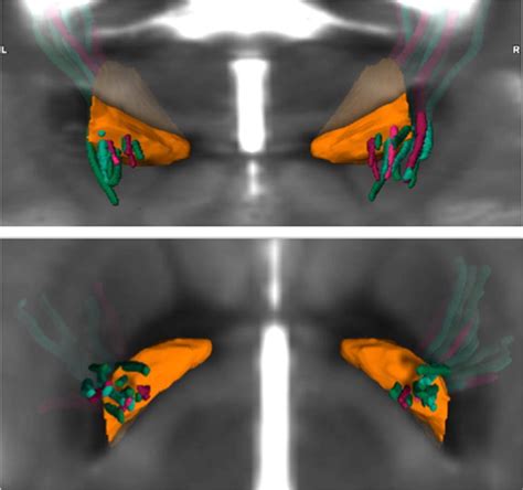 Three Dimensional Imaging Of Electrodes Three Dimensional Imaging Of
