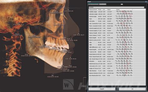 Cephalometric Software Mac