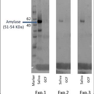 The Three Experiments For Immunodetection Of Alpha Amylase At