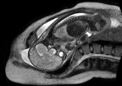 Mri Scan Of Sex Porn Dvd Trailer