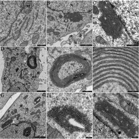 Endoplasmic Reticulum Electron Micrograph