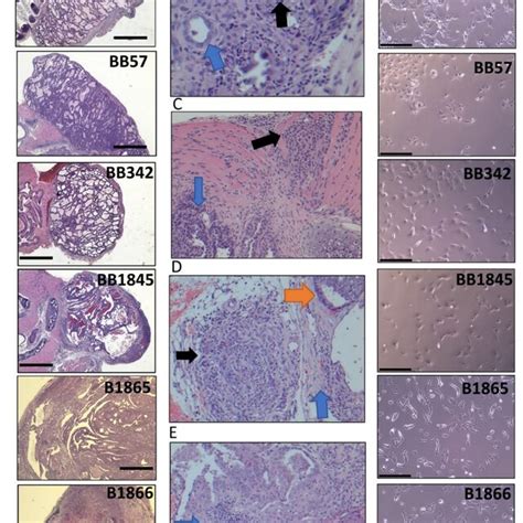 Histology And Pathological Features Of Brafv600e Driven Murine Thyroid