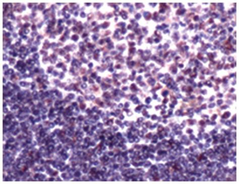 Anti Crebbp Antibody 100ul