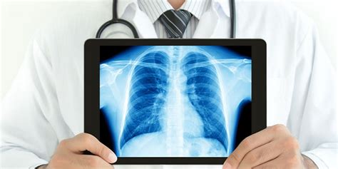 Healthcare Workflow Process Tapping Into Radiology