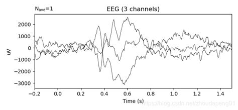 Python中mne库的eeg数据（pca和ica）预处理mne库运行pca代码 Csdn博客