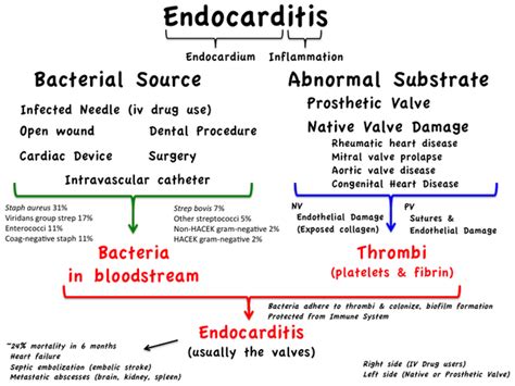 Endocarditis Endocarditis