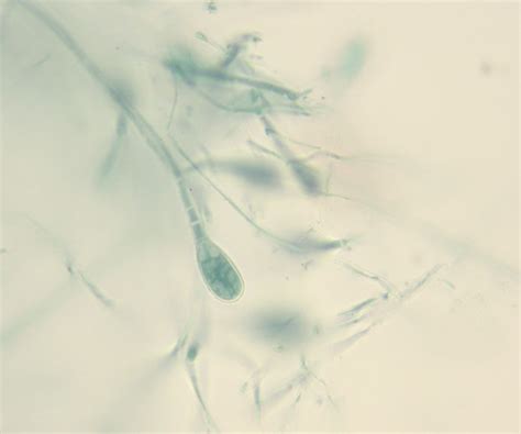 Microsporum Nanum The Macroconidia Enlarged Terminal Stru… Flickr