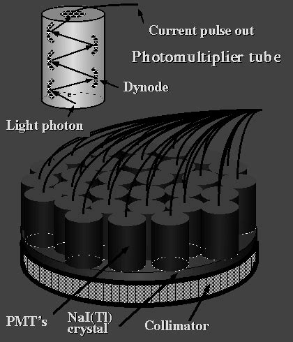 MIR Teaching File Case Mi011