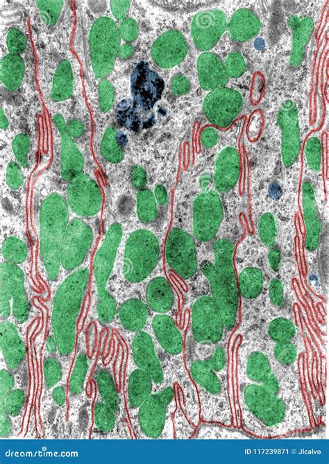Mitochondria Electron Micrograph Labelled