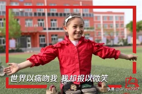 八岁女孩火灾失双腿 手术十二次仍无法装假肢 却比常人活的阳光 搜狐大视野 搜狐新闻